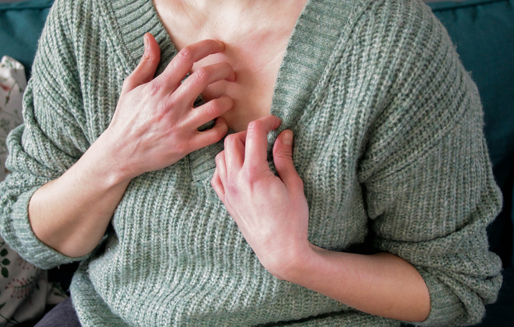 How To Manage Intense Itching A Common Symptom Of Pbc