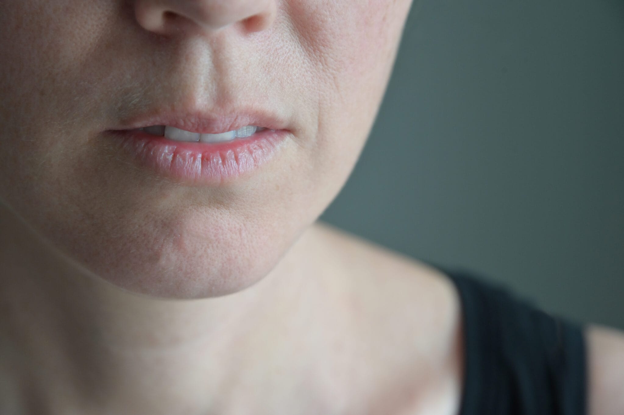 Managing PBC symptoms: Dry mouth